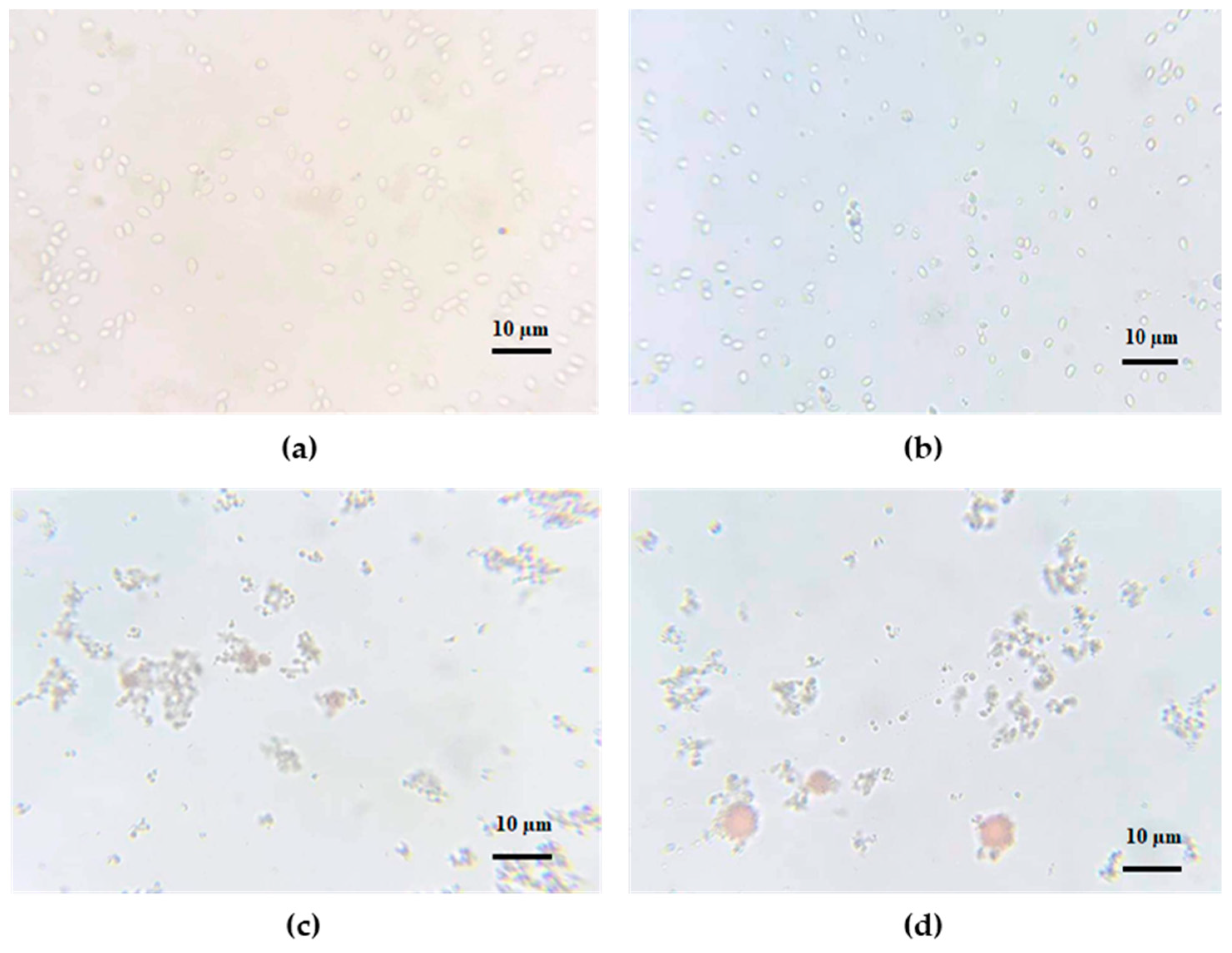 Simultaneous Lipid and Carotenoid Production via Rhodotorula paludigena ...