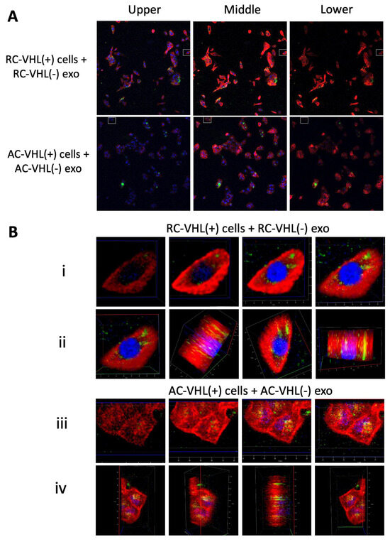 Exosomes from Von Hippel-Lindau-Null Cancer Cells Promote Metastasis in ...