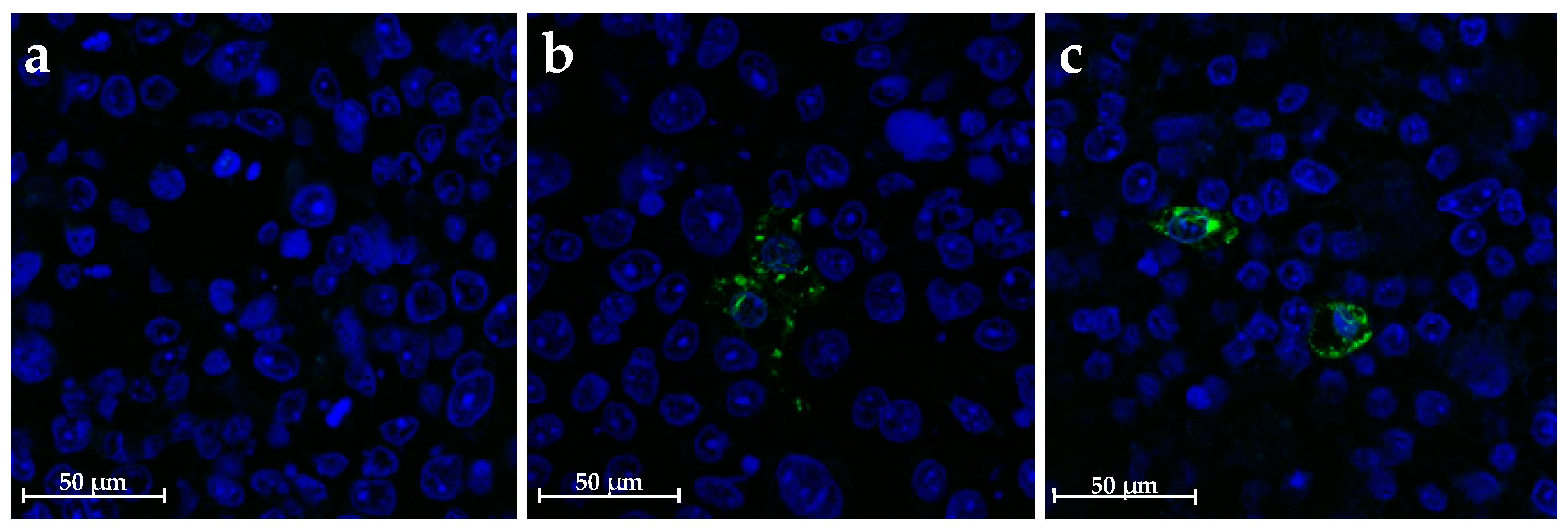 Culture of Human Rotaviruses in Relevant Models Shows Differences in ...