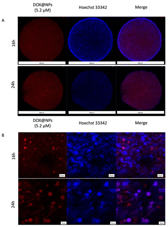 Hybrid Nanoparticle-Assisted Chemo-Photothermal Therapy and ...