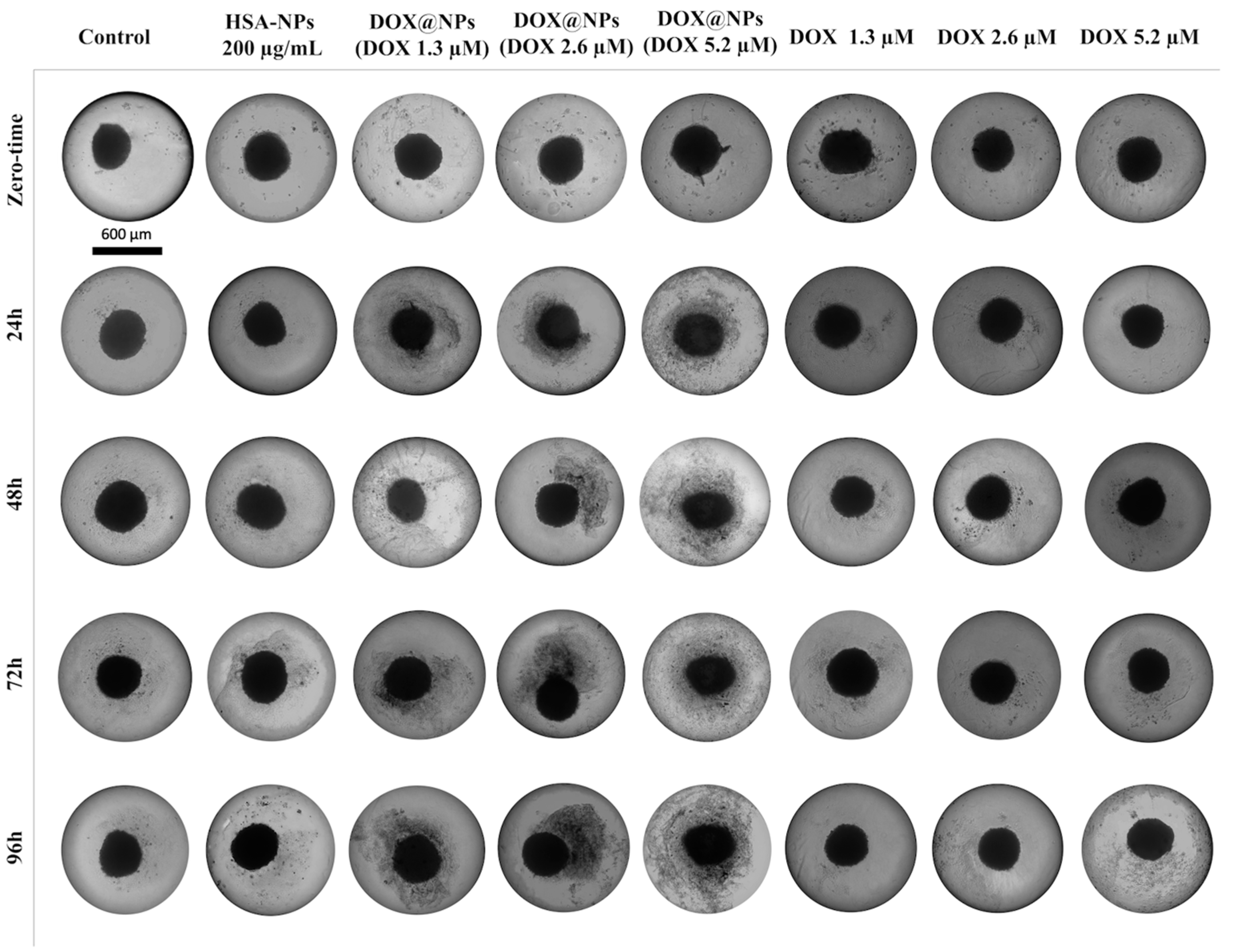 Hybrid Nanoparticle-Assisted Chemo-Photothermal Therapy and ...