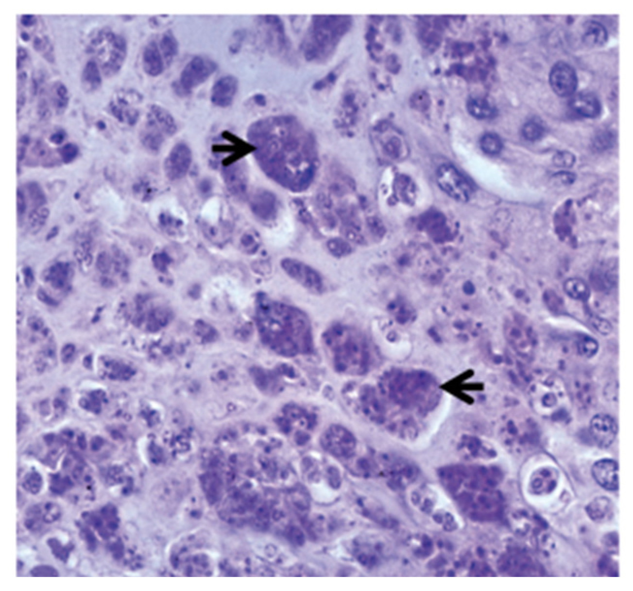 The Immune Response to the Myxozoan Parasite Myxobolus cerebralis in ...