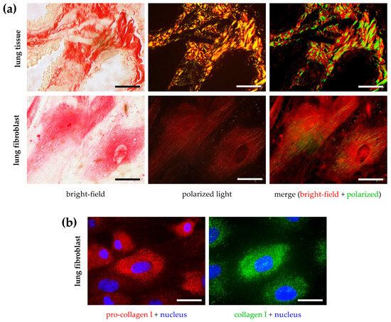 Optimization of Sirius Red-Based Microplate Assay to Investigate ...