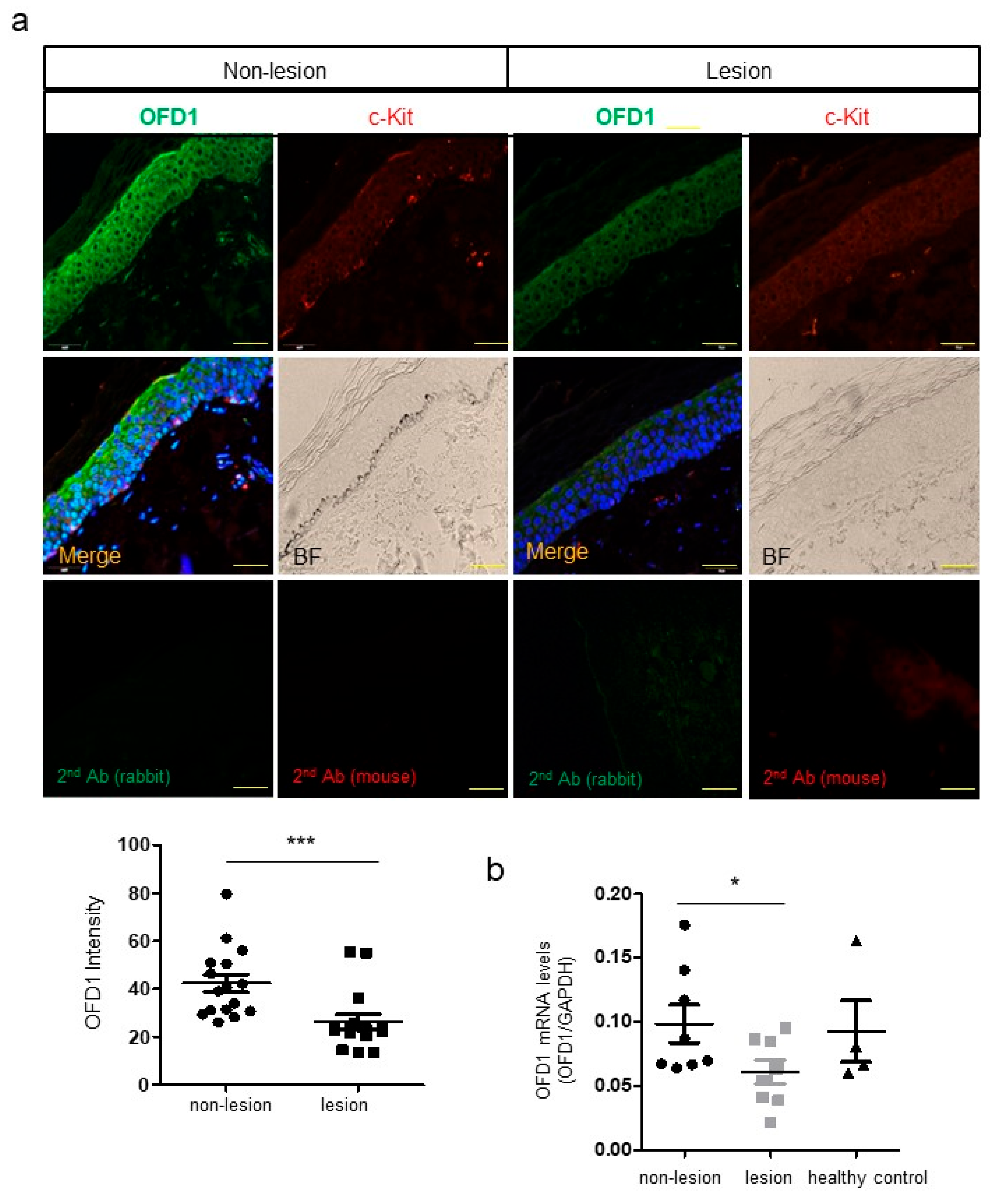 Extraciliary OFD1 Is Involved in Melanocyte Survival through Cell ...