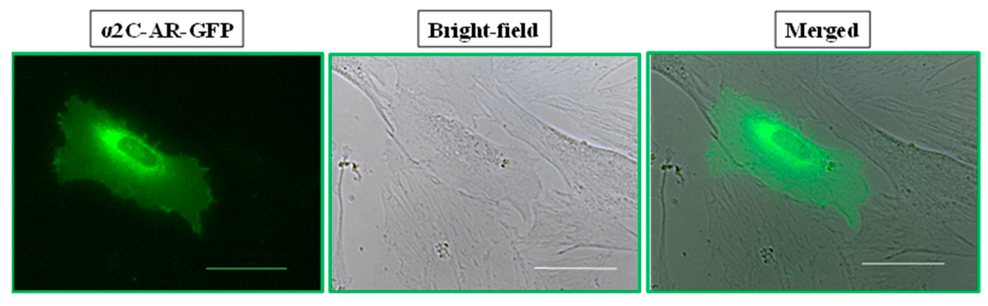 Inhibiting Intracellular α2C-Adrenoceptor Surface Translocation Using ...