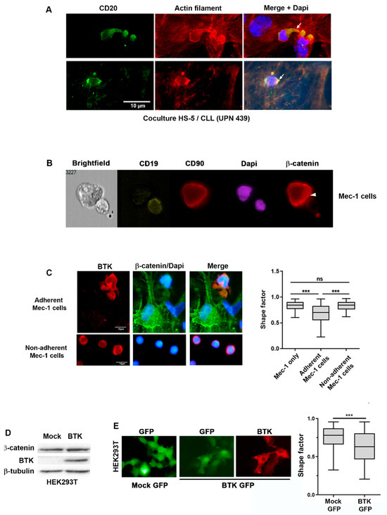 Identification of the Axis β-Catenin–BTK in the Dynamic Adhesion of ...