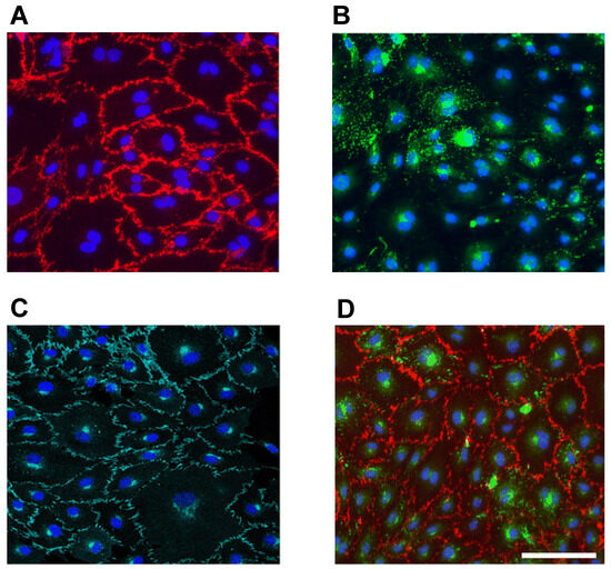 A Comprehensive Look at In Vitro Angiogenesis Image Analysis Software