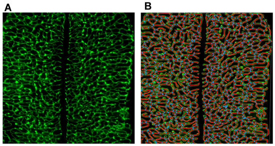 IJMS | Free Full-Text | A Comprehensive Look at In Vitro Angiogenesis ...