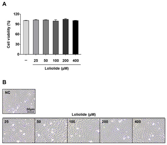 Loliolide in Sargassum horneri Alleviates Ultrafine Urban Particulate ...