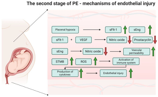 Pathophysiology of Pre-Eclampsia—Two Theories of the Development of the ...
