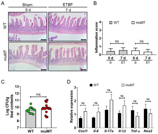 IJMS | Free Full-Text | Promotion of Colitis in B Cell-Deficient C57BL ...