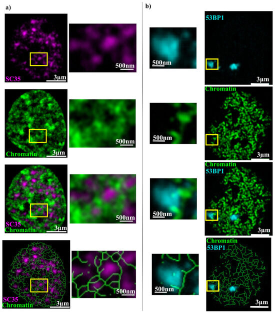 IJMS | Free Full-Text | Chromatin Organization after High-LET ...