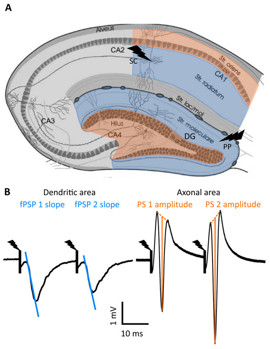 Increased Dentate Gyrus Excitability in the Intrahippocampal Kainic ...
