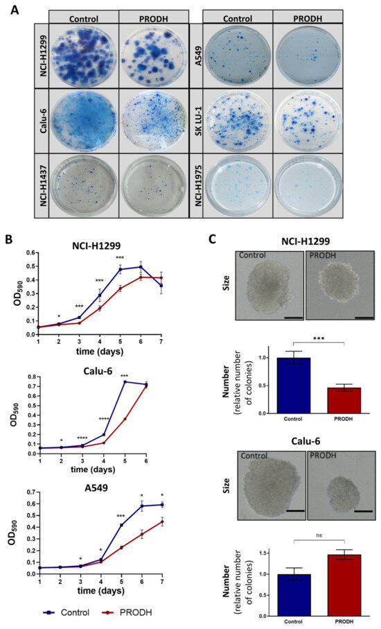 Proline Dehydrogenase (PRODH) Is Expressed in Lung Adenocarcinoma and ...