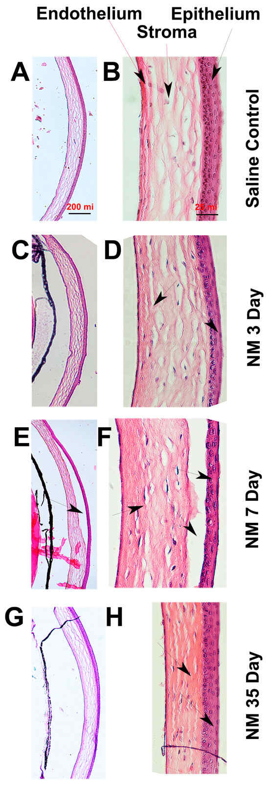 Mouse Model of Nitrogen Mustard Ocular Surface Injury Characterization ...