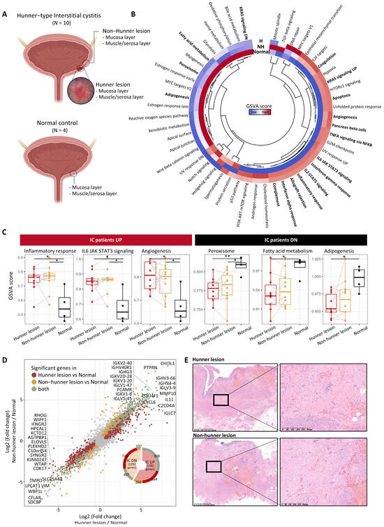 IJMS | Free Full-Text | Potential Role of Macrophage Polarization in ...