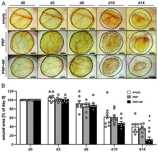 Nanofat Accelerates and Improves the Vascularization, Lymphatic ...
