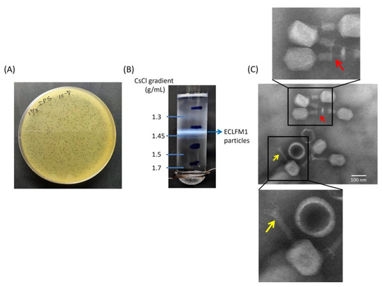 Therapeutic Potential of a Novel Lytic Phage, vB_EclM_ECLFM1, against Carbapenem-Resistant ...