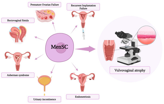 The Concept behind the Suitability of Menstrual Blood-Derived Stem ...