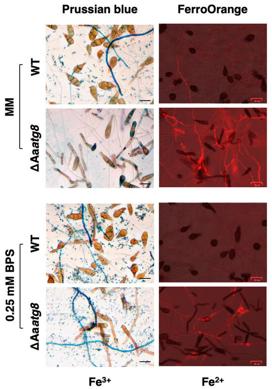 Contribution of Autophagy to Cellular Iron Homeostasis and Stress ...