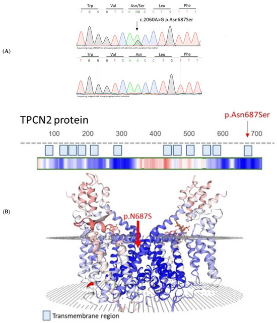 Missing Heritability in Albinism: Deep Characterization of a Hungarian ...
