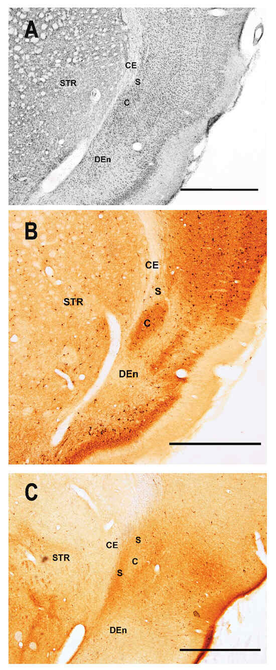 Degenerative Changes in the Claustrum and Endopiriform Nucleus after ...
