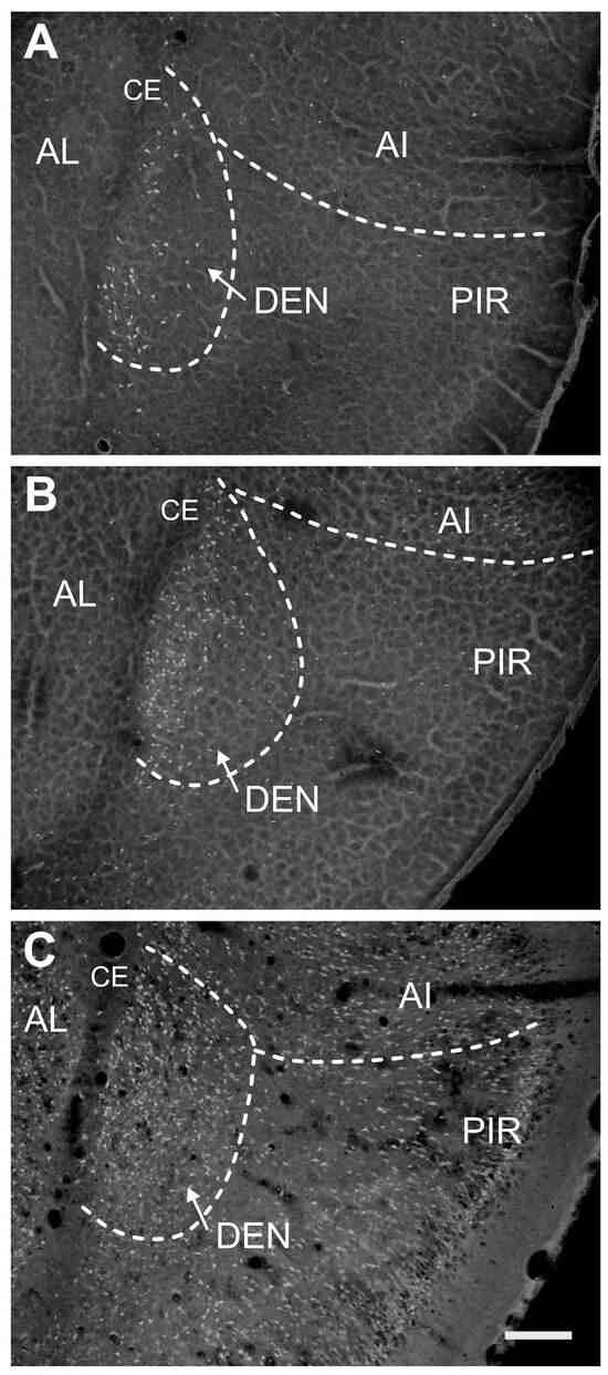 Degenerative Changes in the Claustrum and Endopiriform Nucleus after ...