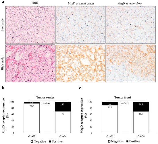 The Expression of Alamandine Receptor MrgD in Clear Cell Renal Cell ...