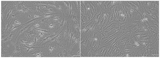 Effect of Selected Antioxidants on the In Vitro Aging of Human Fibroblasts