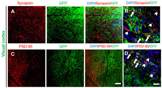 Neural Stem Cells Transplanted into Rhesus Monkey Cortical Traumatic ...