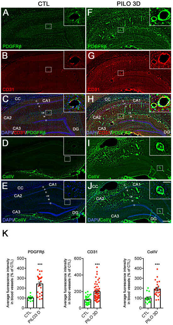 In the Rat Hippocampus, Pilocarpine-Induced Status Epilepticus Is ...