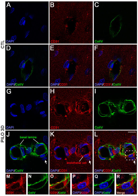 In the Rat Hippocampus, Pilocarpine-Induced Status Epilepticus Is ...