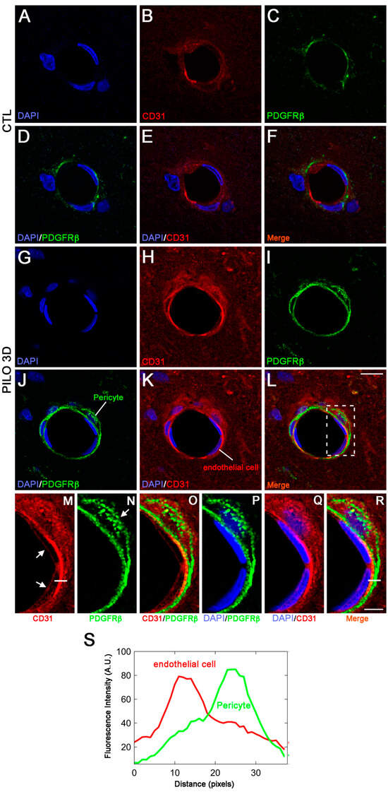 In the Rat Hippocampus, Pilocarpine-Induced Status Epilepticus Is ...