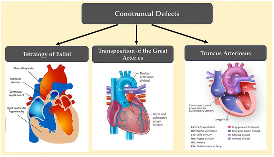 In-Depth Genomic Analysis: The New Challenge in Congenital Heart Disease