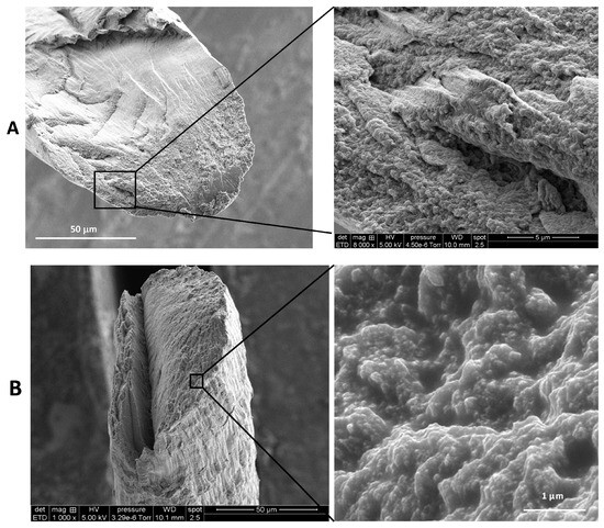 Wet-Spun Chitosan–Sodium Caseinate Fibers for Biomedicine: From ...