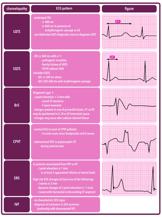 Primary Electrical Heart Disease—Principles of Pathophysiology and Genetics
