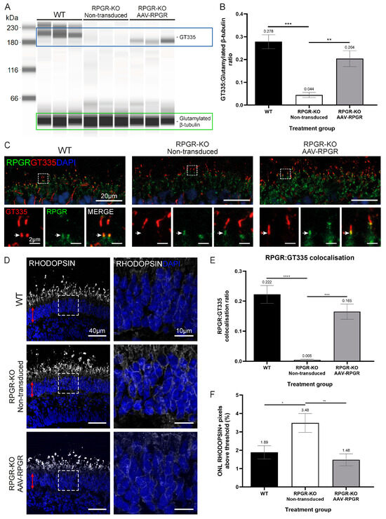 AAV-RPGR Gene Therapy Rescues Opsin Mislocalisation in a Human Retinal ...