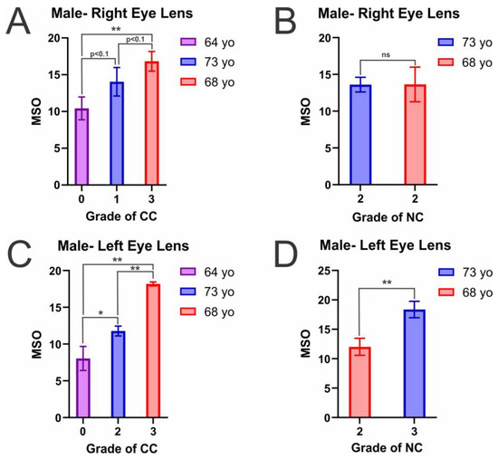 Association of Alpha-Crystallin with Human Cortical and Nuclear Lens ...