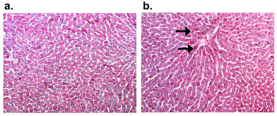 Assessment of the Impact of Carvedilol Administered Together with ...