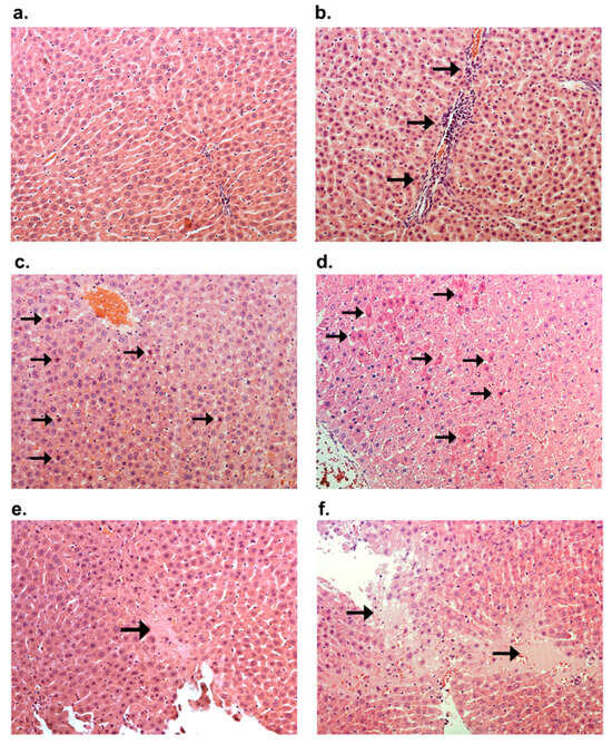 Assessment of the Impact of Carvedilol Administered Together with ...
