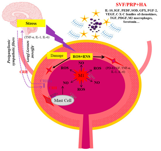The Model of Interstitial Cystitis for Evaluating New Molecular ...