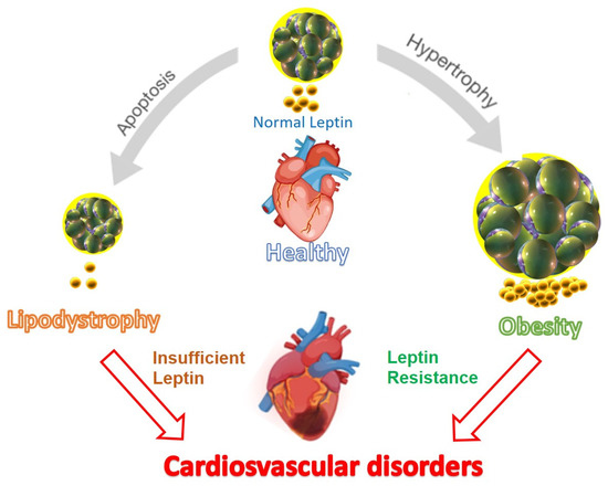Role of Leptin in Obesity, Cardiovascular Disease, and Type 2 Diabetes