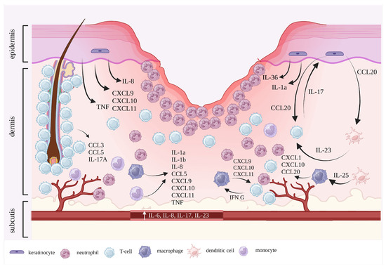 The Pathophysiology and Treatment of Pyoderma Gangrenosum—Current ...