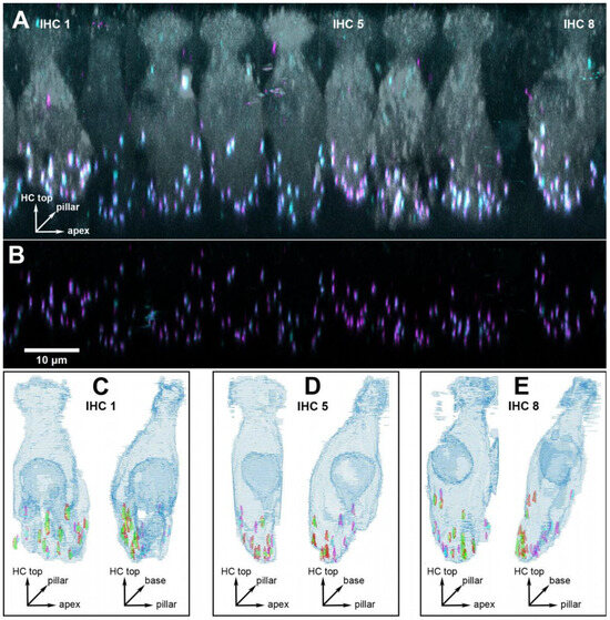 Cochlear Ribbon Synapses in Aged Gerbils