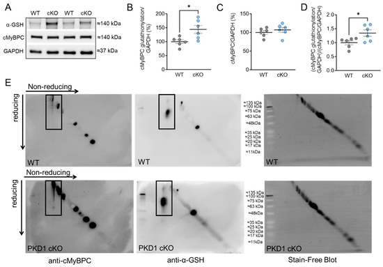 Protein Kinase D Plays a Crucial Role in Maintaining Cardiac ...