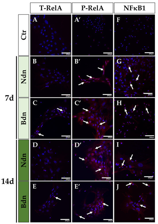 IJMS | Free Full-Text | Anabolic Steroids Activate the NF-κB Pathway in ...