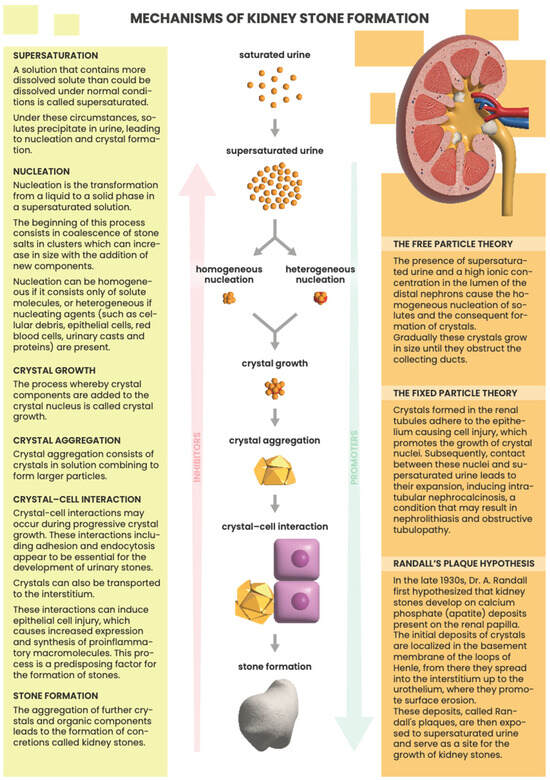 Pathophysiology and Main Molecular Mechanisms of Urinary Stone ...