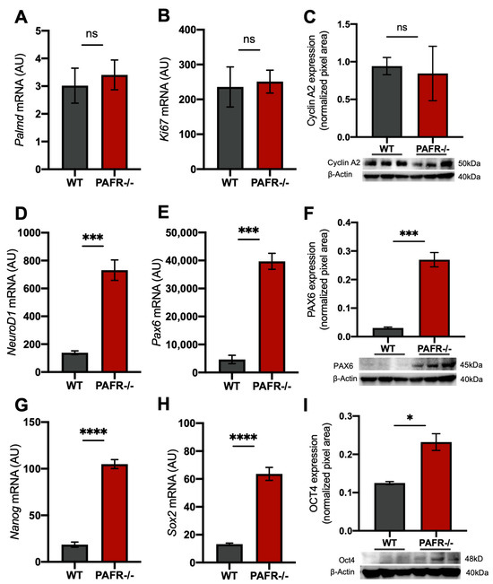 Platelet-Activating Factor Receptor (PAFR) Regulates Retinal Progenitor ...