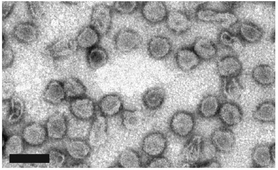 The Expanding Diversity of Viruses from Extreme Environments