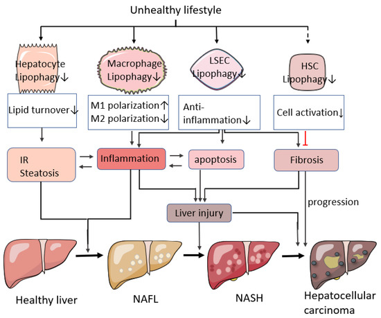 Research Progress on Lipophagy-Mediated Exercise Intervention in Non ...